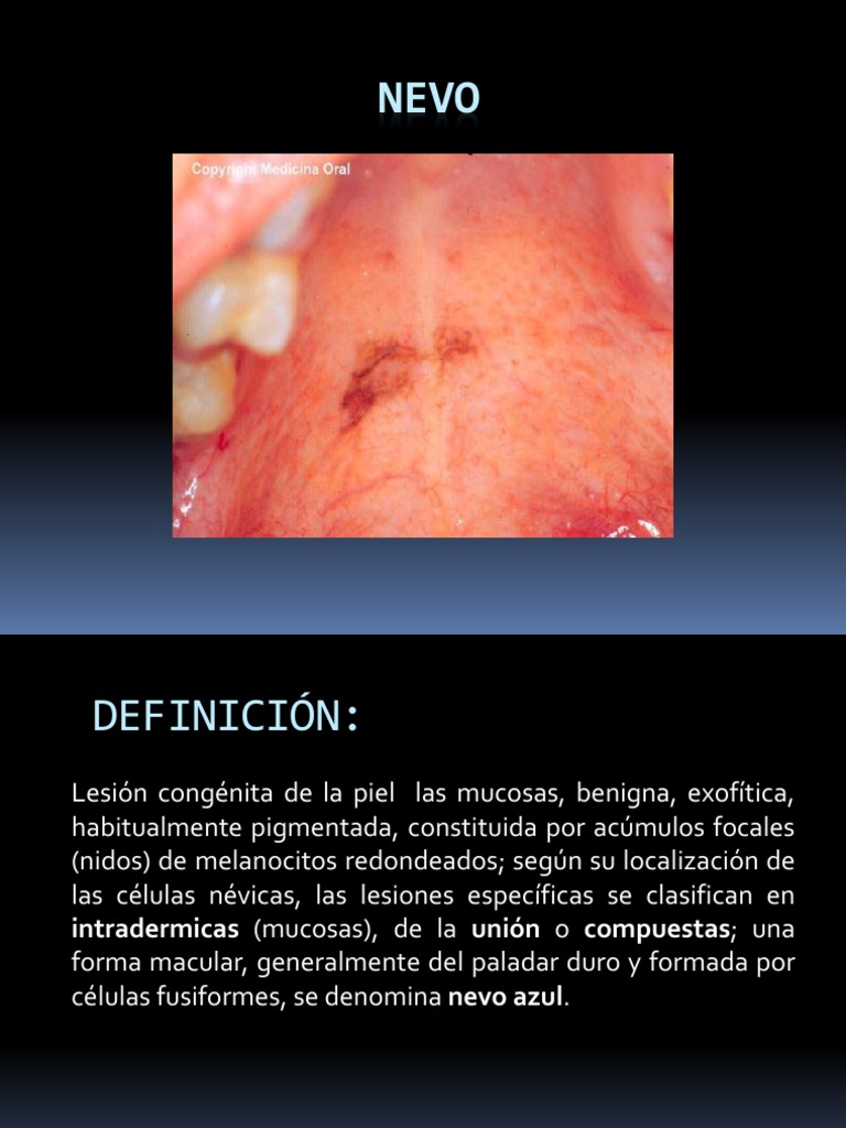 NEVO | Epitelio | Membrana mucosa