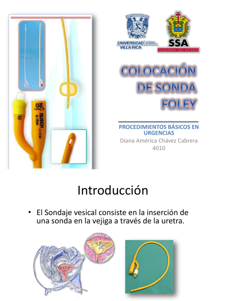 Colocación de Sonda Foley | Vejiga urinaria | Urología