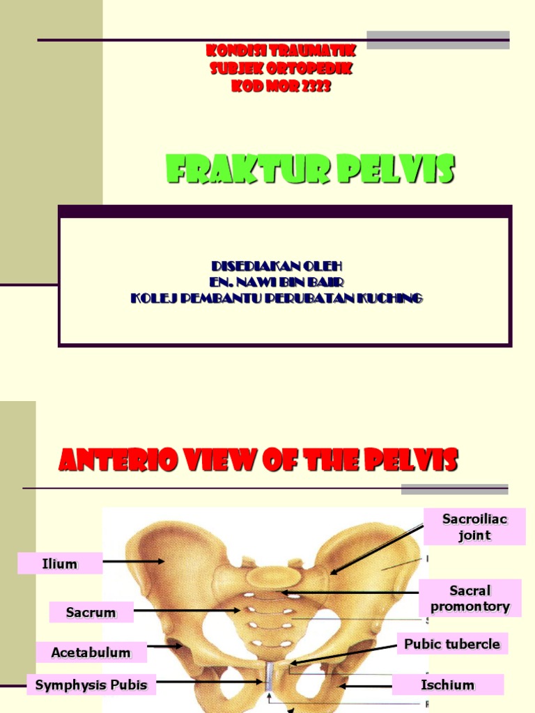 Fraktur Pelvis dan Jenis Kecederaannya | PDF