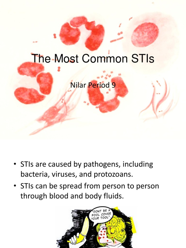 The Most Common Stis | PDF