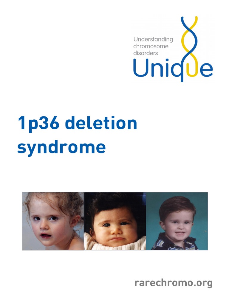 1p36 Deletions FTNW | PDF | Congenital Heart Defect | Heart