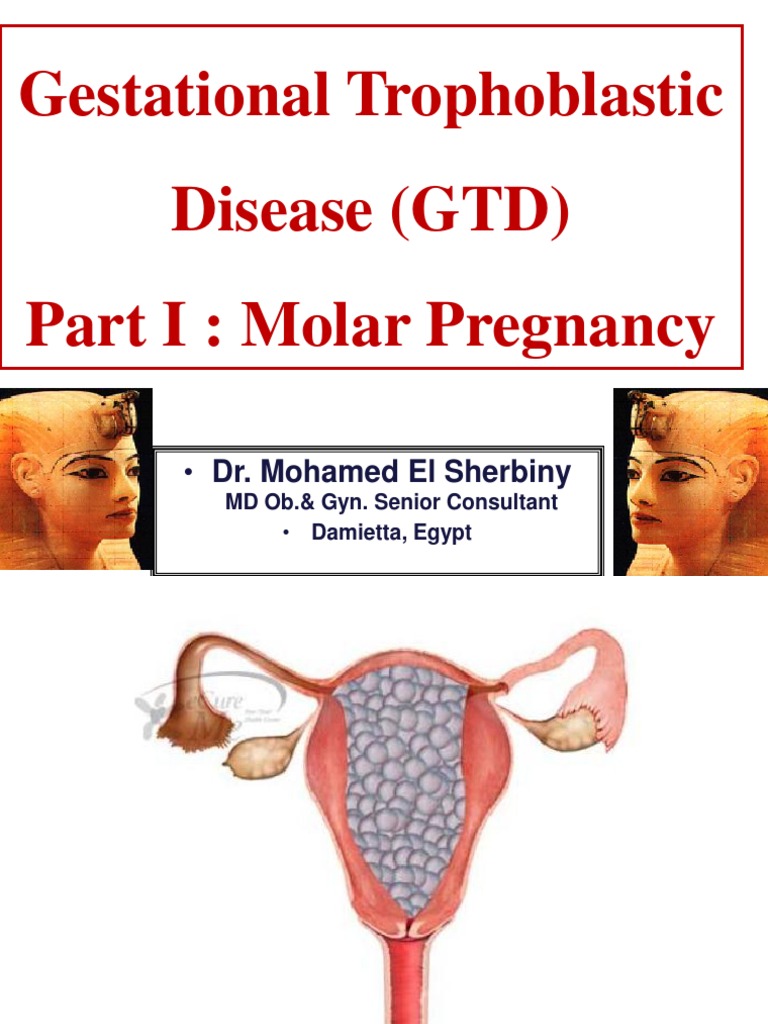 Gestational Trophoblastic Disease (GTD) Part I: Molar Pregnancy | PDF ...