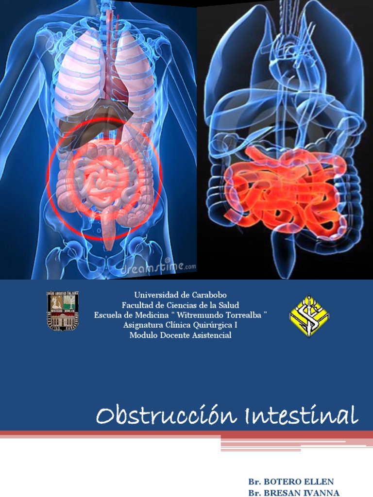 Clinica Quirurgica I. Obstruccion Intestinal Final | PDF | Digestión ...