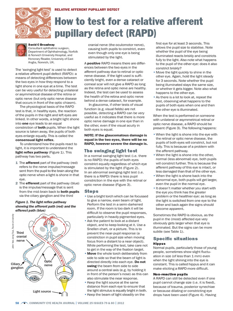 RAPD | Human Eye | Eye