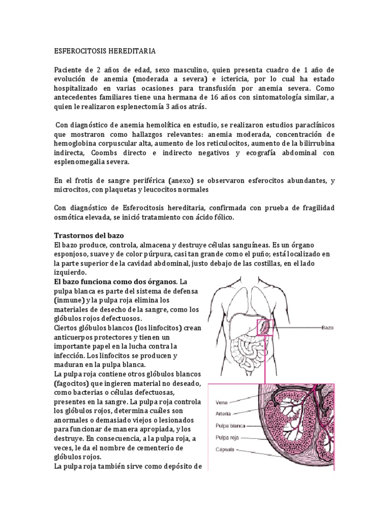 Esferocitosis Hereditaria | PDF | Sangre | Bazo