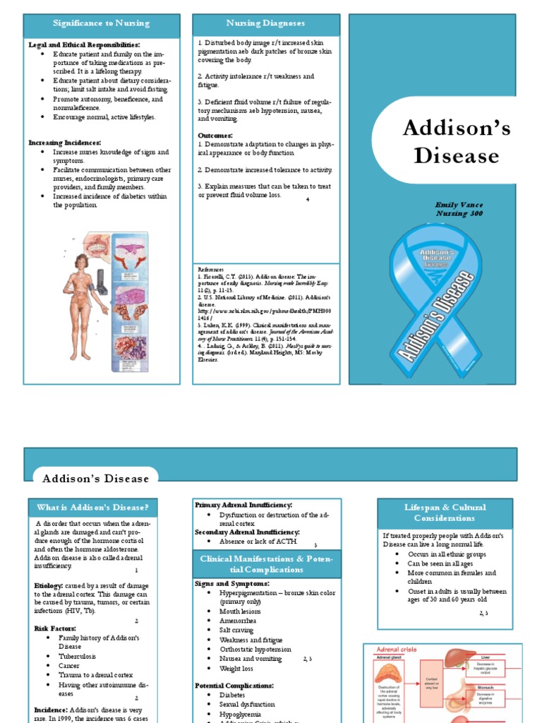 addisons | Adrenal Gland | Epidemiology