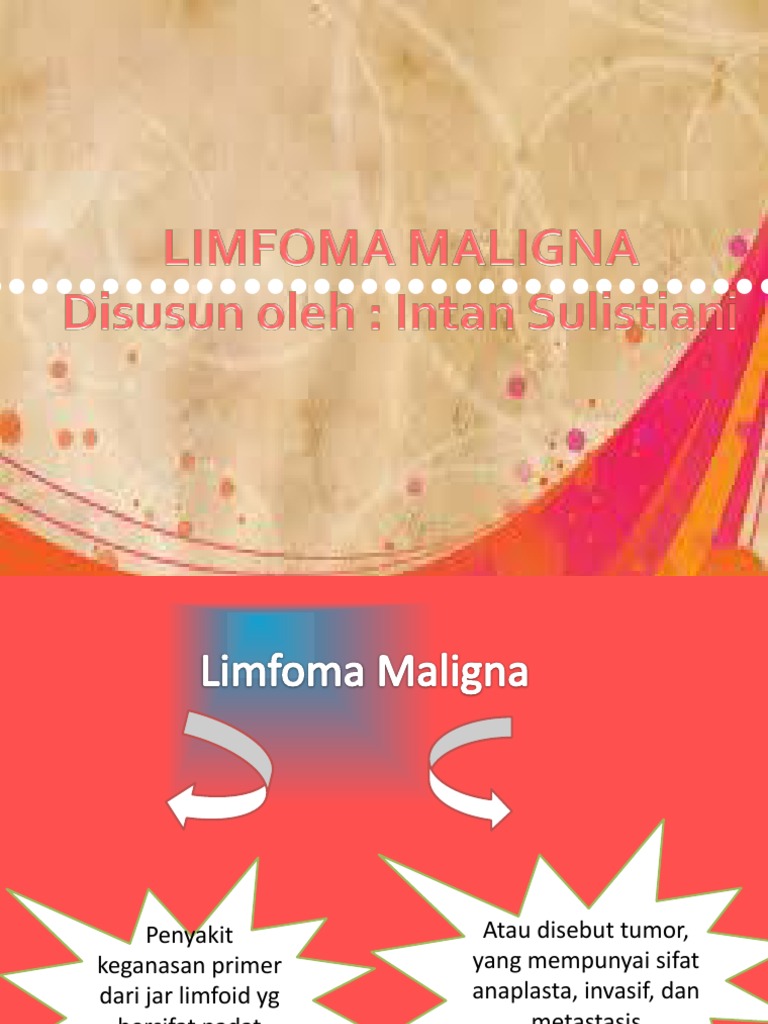 Limfoma Hodgkin | PDF