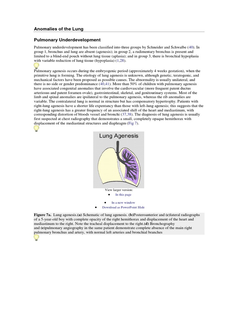 Classification, Diagnosis, and Imaging Findings of Pulmonary ...