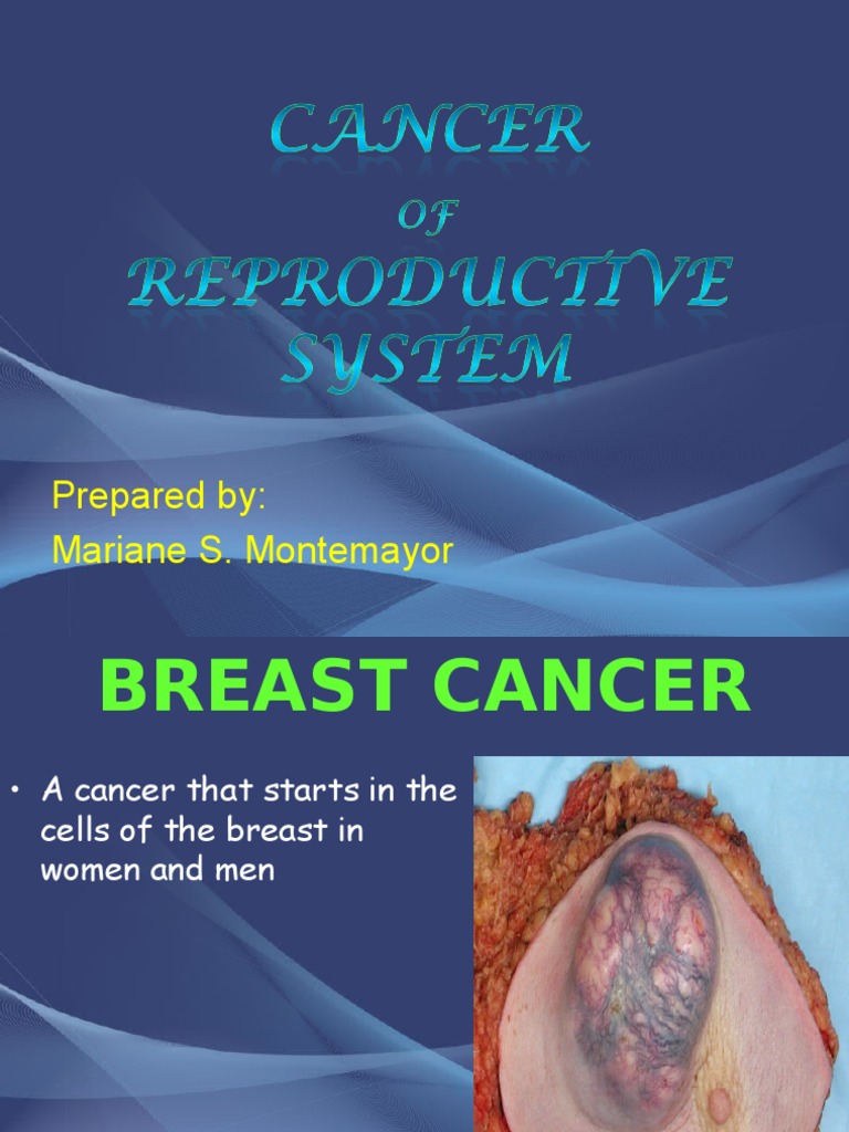 Overview of Breast and Reproductive Cancers | PDF | Cervical Cancer ...