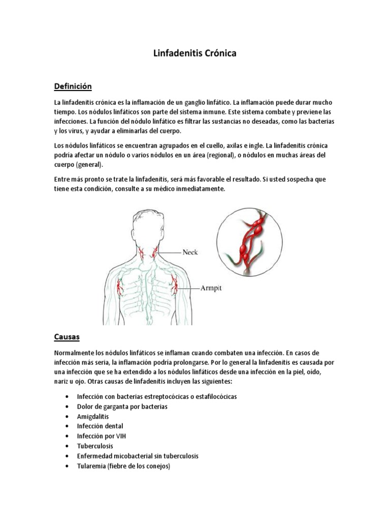 Linfadenitis Crónica | Timo | Infección