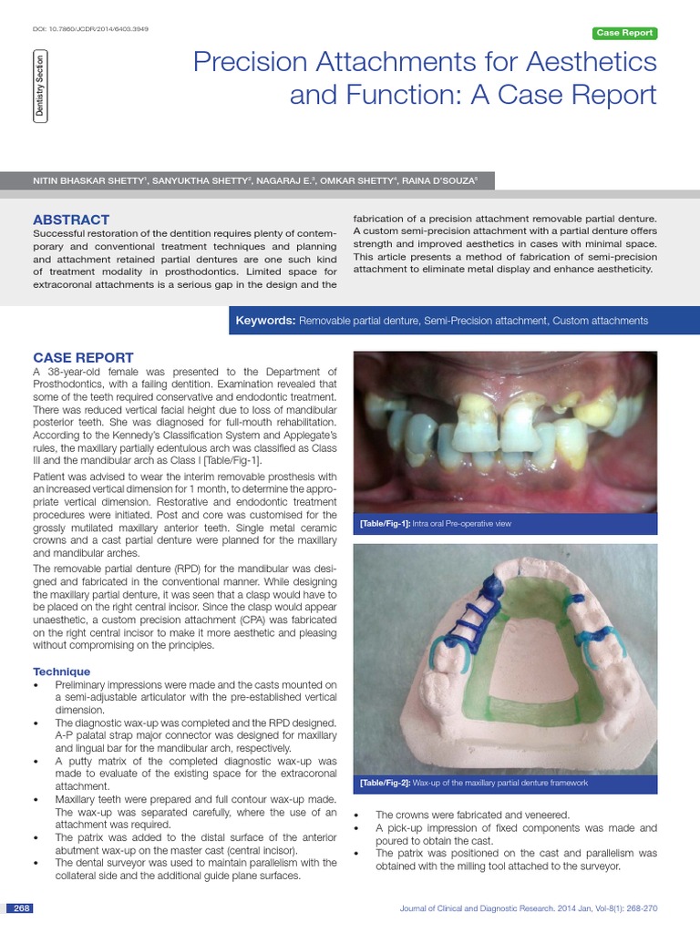 85-6403_E(C)_F(T)_PF1(MH)_PFA(H) | Dentures | Dental Implant