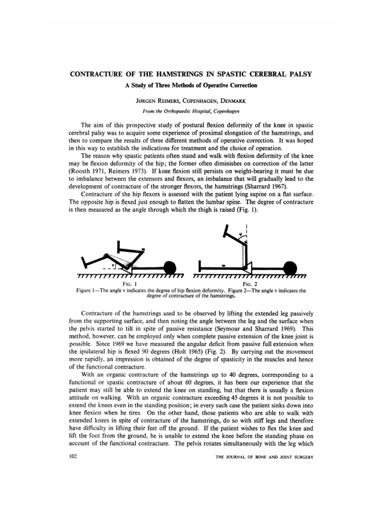 Contracture of Hamstrings in CP | Download Free PDF | Knee | Anatomical ...