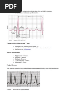 Delta Wave - LITFL Medical Blog - ECG Library Basics | PDF | Cardiac ...
