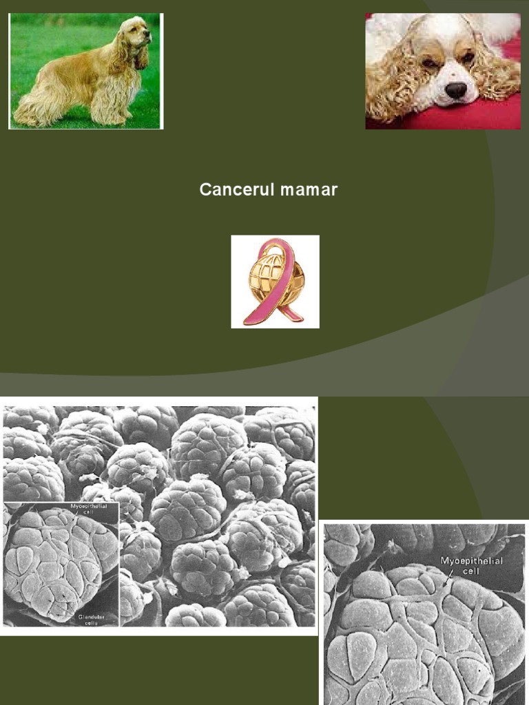 cancerul mamar