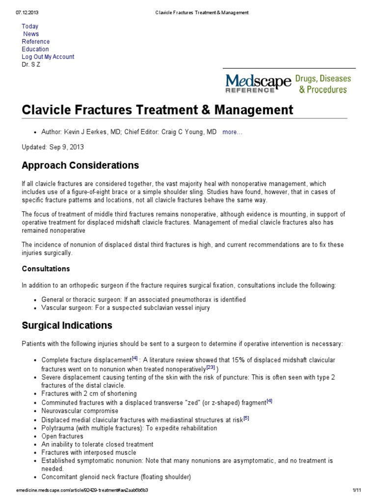 Clavicle Fractures Treatment & Management | PDF | Orthopedic Surgery ...