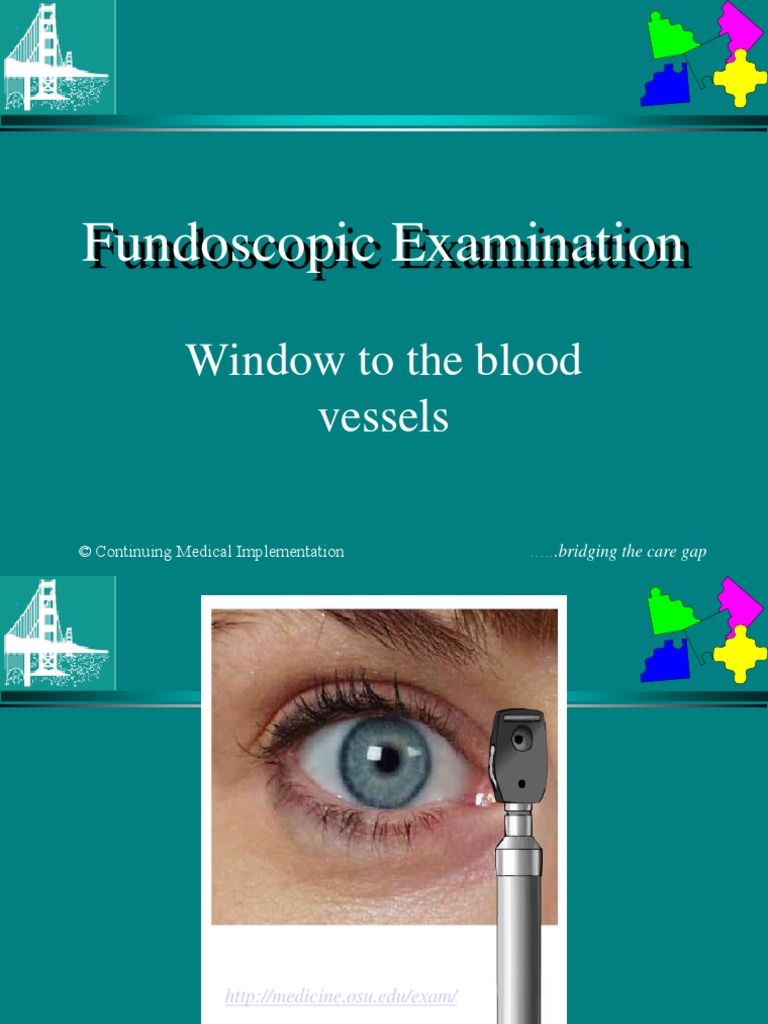 Fundoscopic Examination | PDF | Retina | Ophthalmology