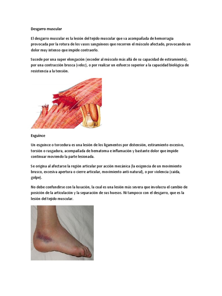 Desgarro Muscular: Causas y Síntomas | PDF | Deportes | Lesión