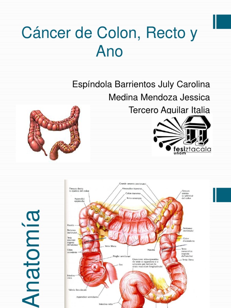 Cáncer de Colon, Recto y Ano | PDF | Cáncer colonrectal ...