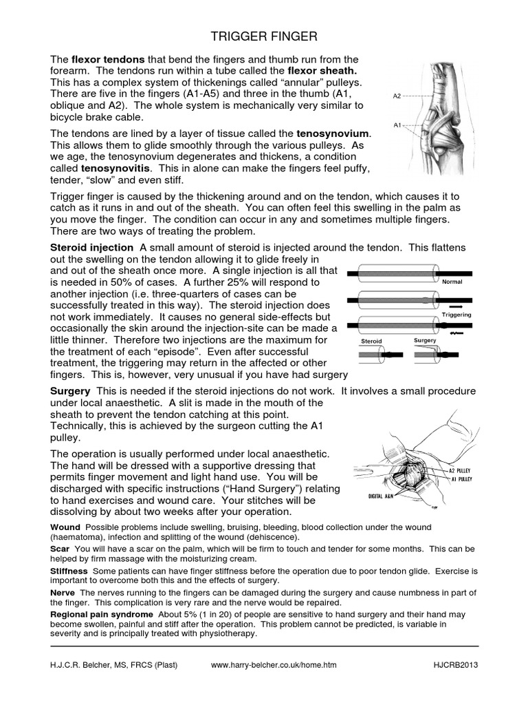 Trigger Finger | PDF | Surgery | Finger