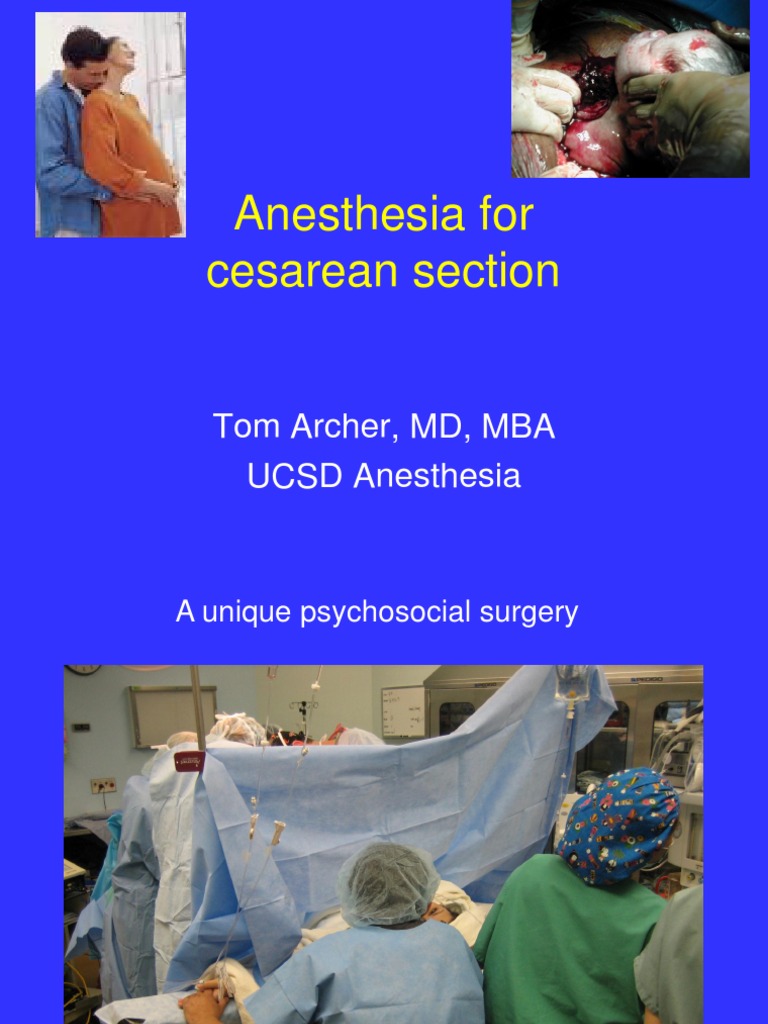 Anesthesia For Cesarean Section | PDF | Vein | Vasodilation