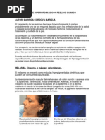 Efélides: Pecas y su Tratamiento | PDF | Piel | Dermatología