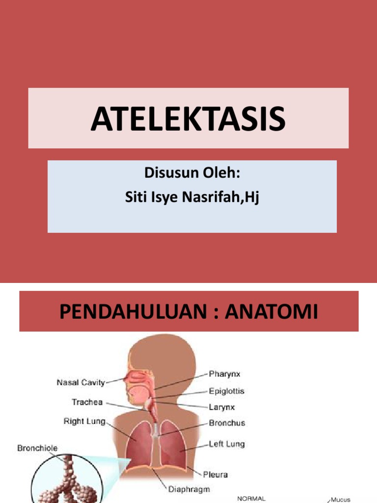 Radiologi Atelektasis | PDF