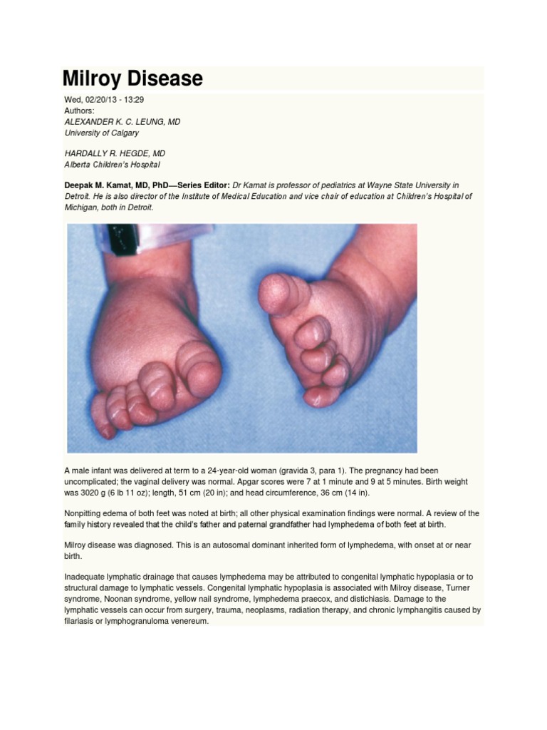 Milroy Disease Pak Tomo | PDF | Edema | Health Sciences