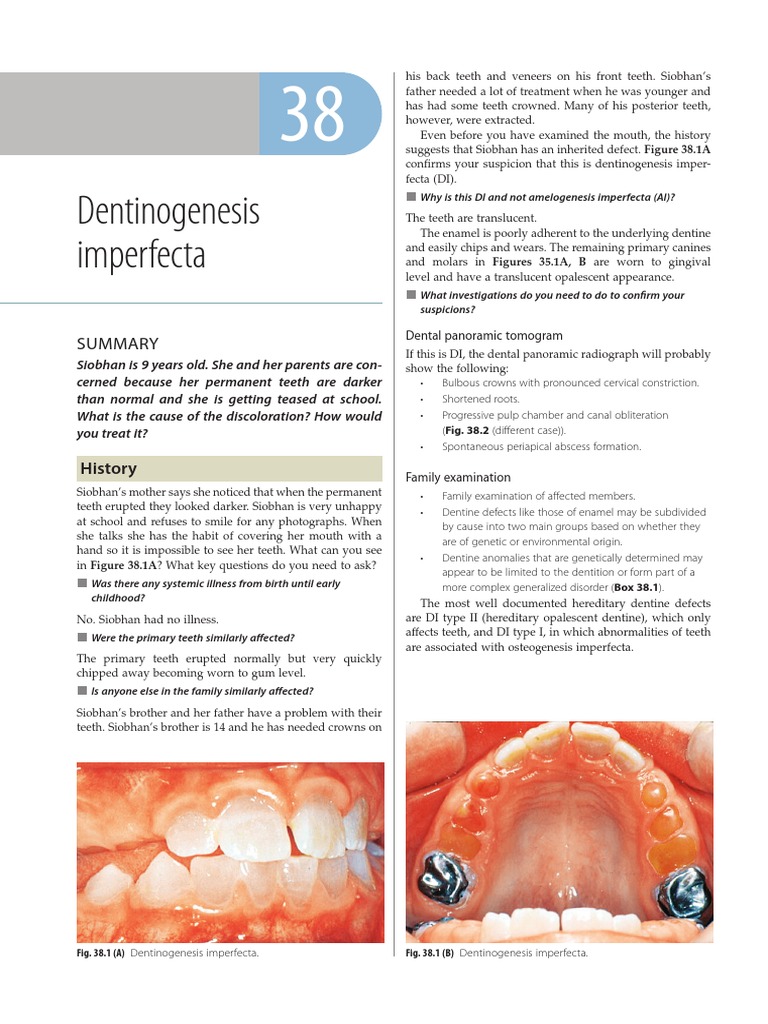 Dentinogenesis Imperfecta | PDF | Dentin | Tooth Enamel