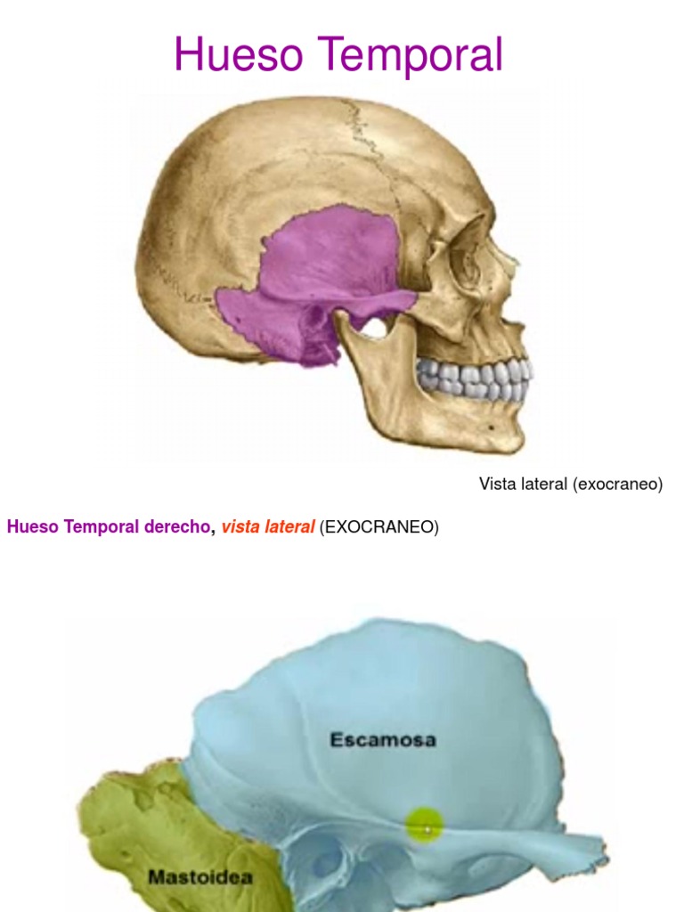 Hueso Temporal