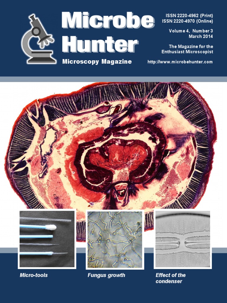 Microbe Hunter Marzo | PDF | Staining | Aperture