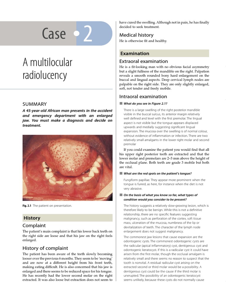 2.a Multilocular Radiolucency | Biopsy | Medicine