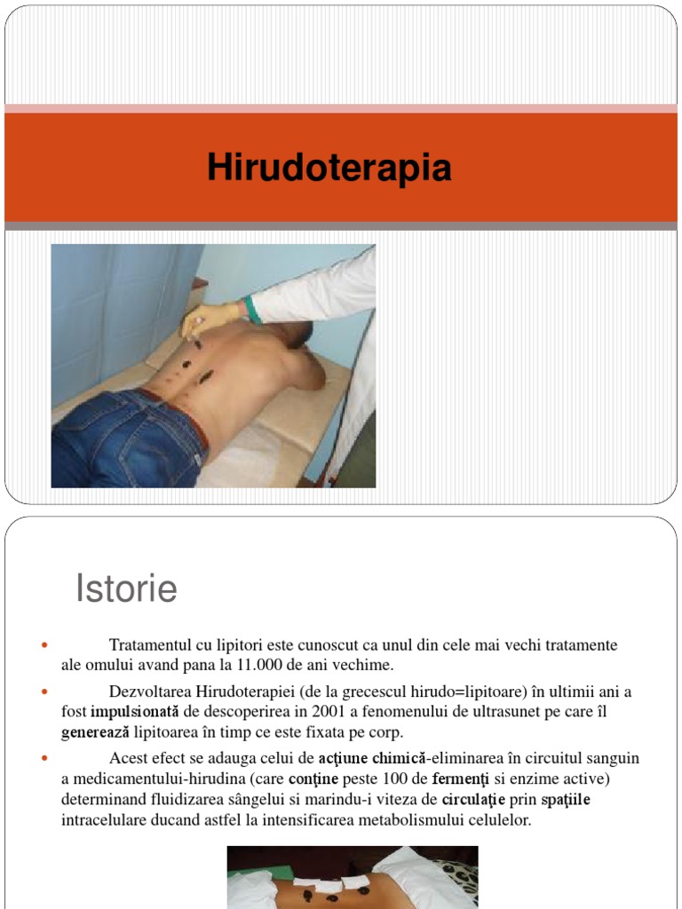 Hirudoterapia | PDF