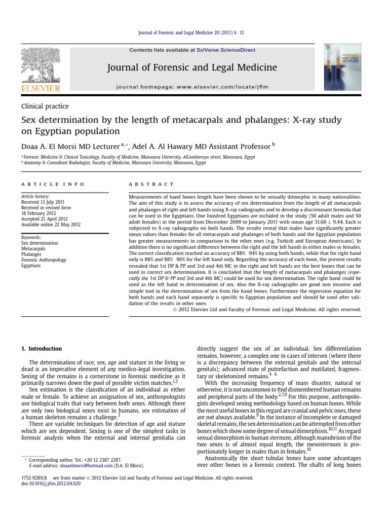 Sex Determination From Metacarpal And Phalang Pdf Hand Radiology