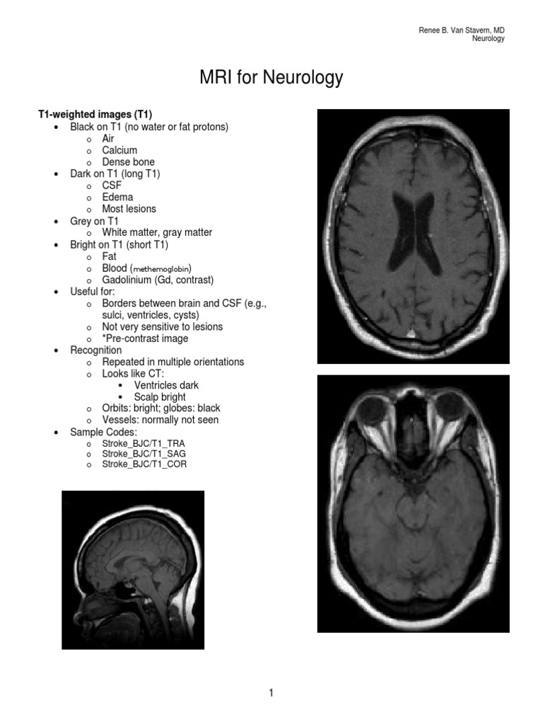 Week 3 Handout MRI For Neurology | PDF