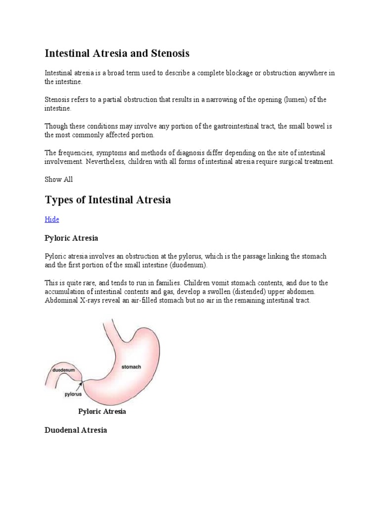 Intestinal Atresia And Stenosis Gastrointestinal Tract Stomach