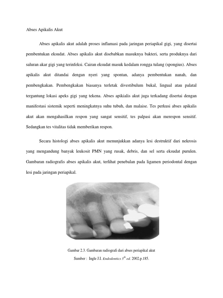 Abses Apikalis Akut | PDF