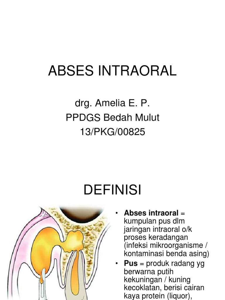 Abses Intraoral | PDF | Microbiology | Drugs