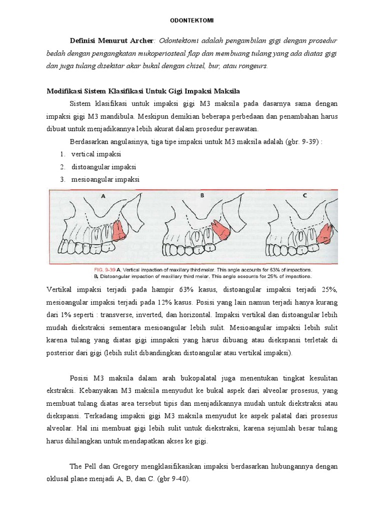 Teknik Odontektomi | PDF