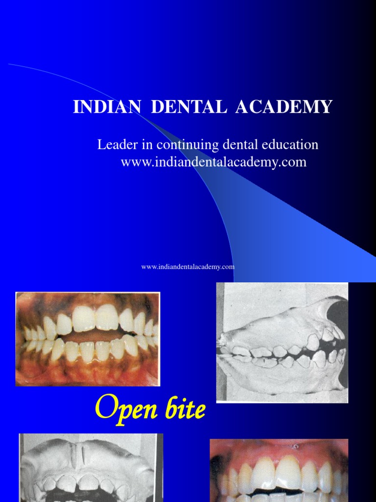 Open Bite Sem (Recovered) / Orthodontic Courses by Indian Dental ...