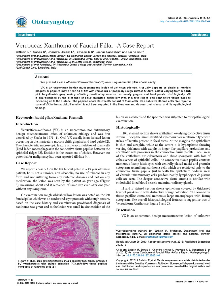 Verroucas Xanthoma of Faucial Pillar A Case Report 2161 119X.1000144 ...