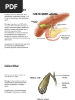 Hidrocolecisto y Piocolecisto: Definición y Tratamiento | PDF
