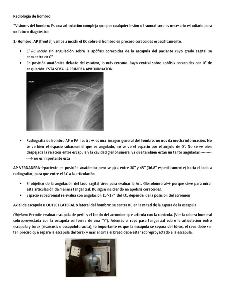 Radiografía del hombro: Técnicas radiográficas y criterios de evaluación para el estudio de ...
