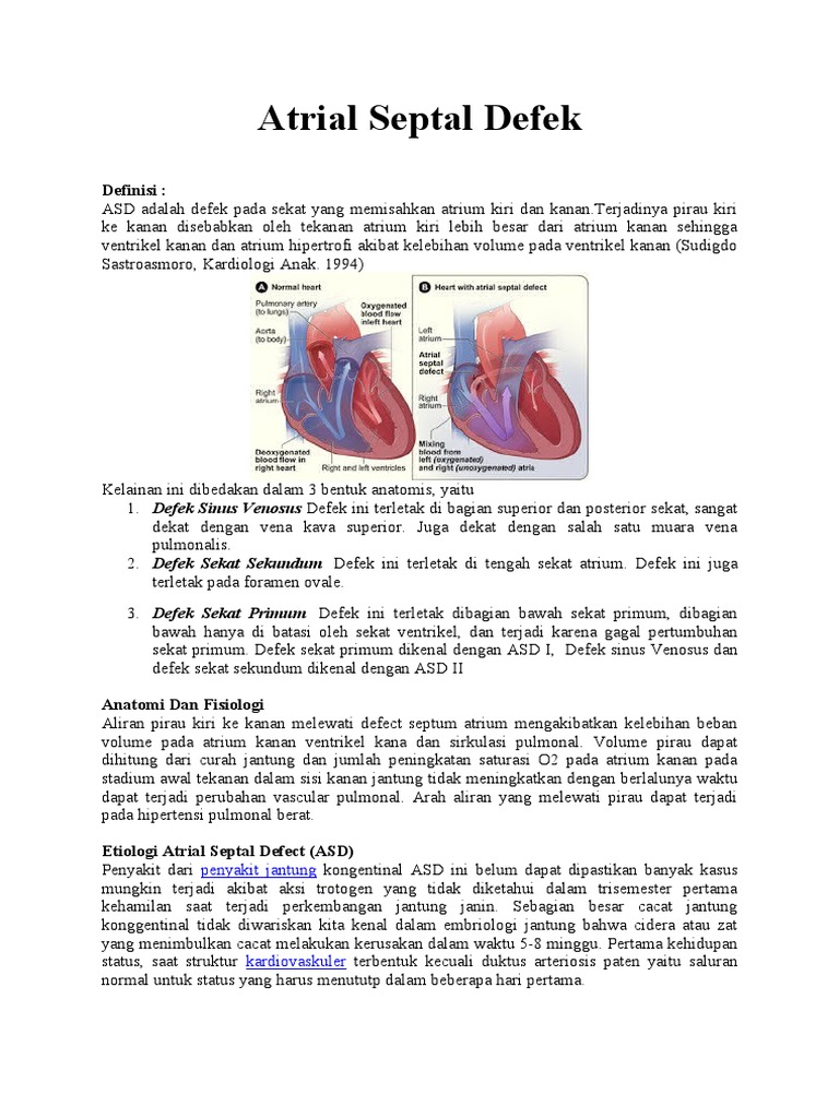 Atrial Septal Defek | PDF