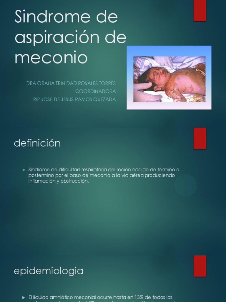 Sindrome de Aspiración de Meconio | PDF