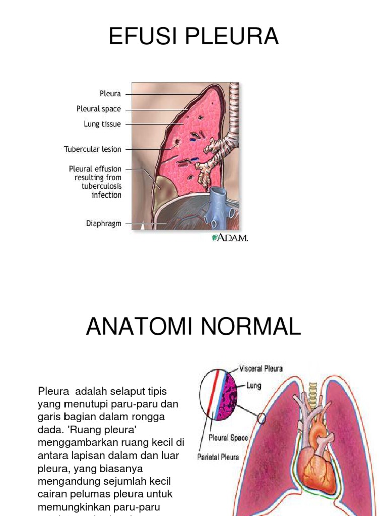 Efusi Pleura | PDF | Sistem Pernapasan | Obat Klinis