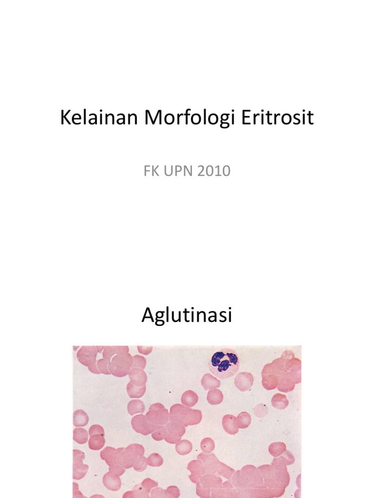 Kelainan Morfologi Eritrosit Pdf