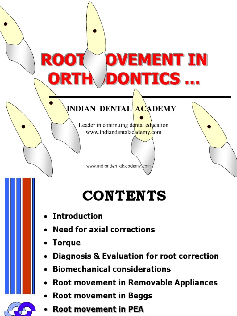 Root Movement in Orthodontics / orthodontic courses by Indian dental ...