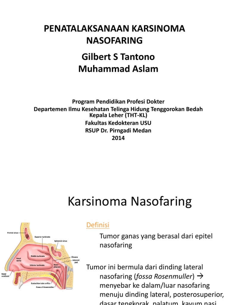 Karsinoma Nasofaring | PDF