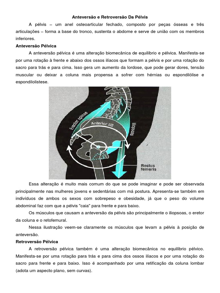 Anteversão e Retroversão Da Pélvis | PDF