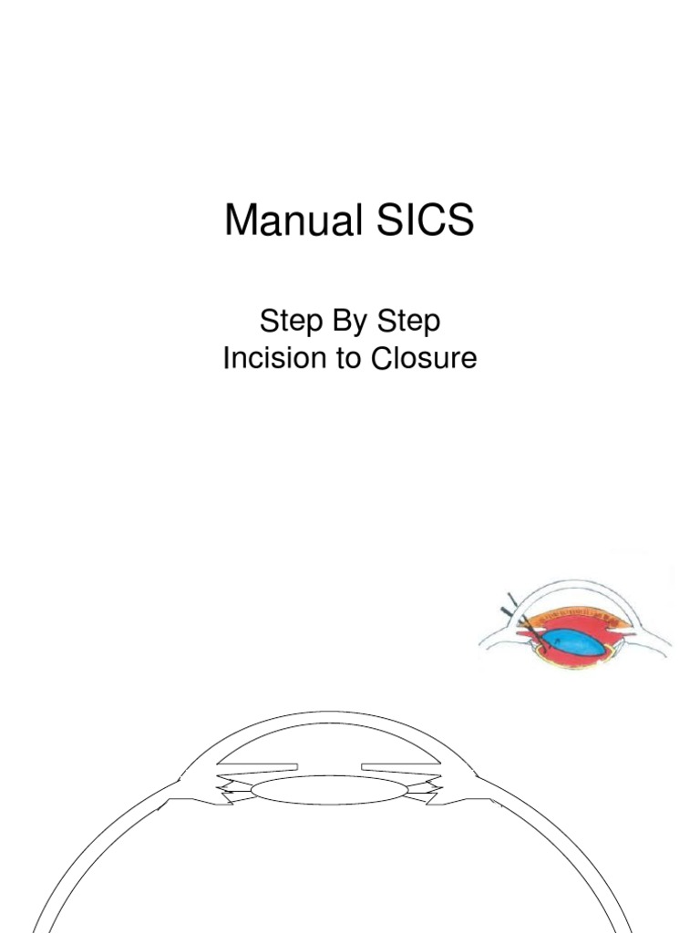 Manual SICS: Step by Step Incision To Closure | PDF